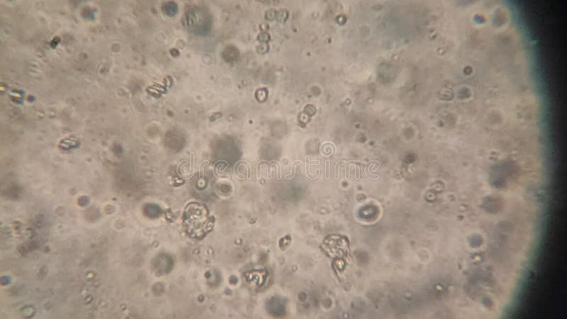 Alternaria Mold Under the Microscope Stock Video - Video of shaped ...