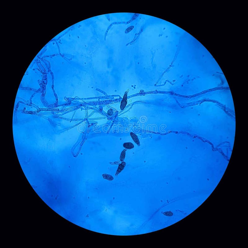 Alternaria Sp Stock Photos - Free & Royalty-Free Stock Photos from ...