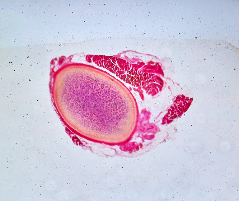 Life under a microscope stock photo. Image of plant - 309095398