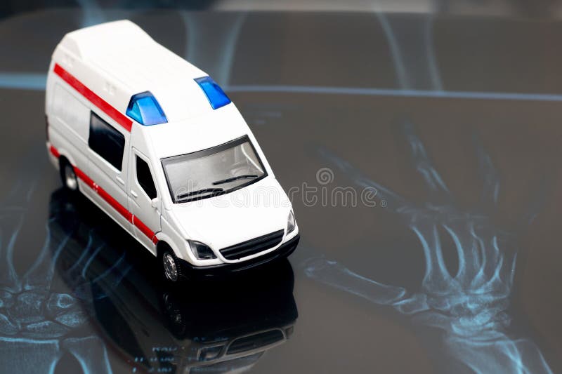 Ambulance and X-ray of the Hand Closeup Stock Image - Image of hospital ...
