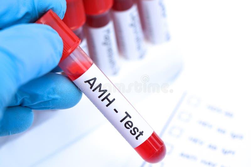AMH Test To Look for Abnormalities from Blood Stock Photo - Image of ...