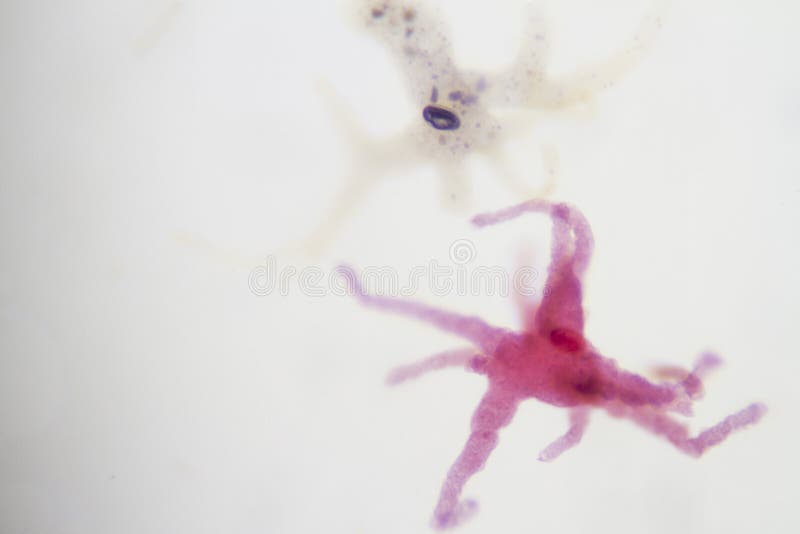 Amibe photo stock. Image du microbiologie, maladie, vacuole - 169339876
