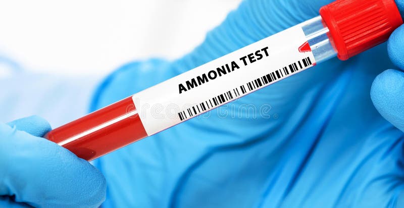 Ammonia Test stock image. Image of care, hand, assesses - 337401749