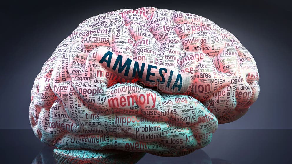 Amnesia and a human brain stock illustration. Illustration of cloud - 247647639