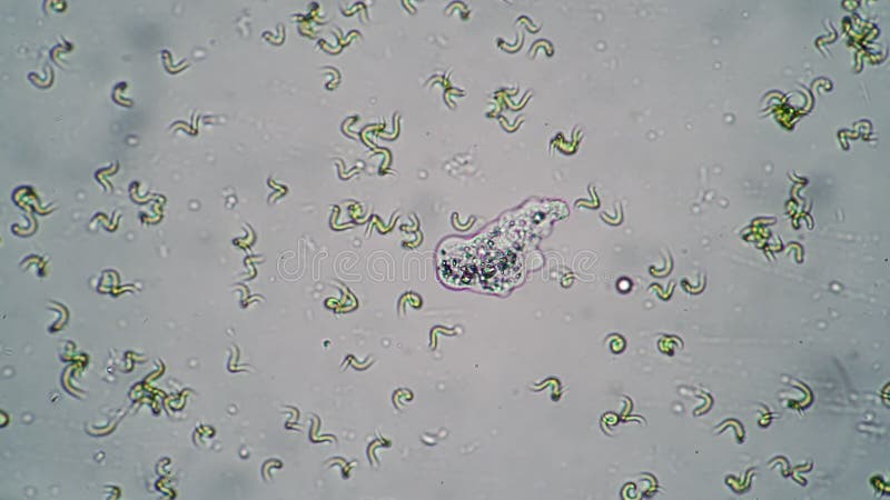 Microcosm of the Amoeba Moves in Water among Algae Close-up Timelapse ...