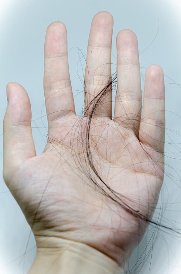 Hair falling on hand stock image. Image of illness, holding - 182133117