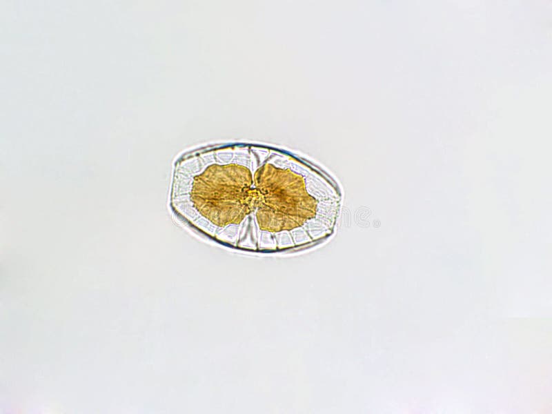 Amphora Sp. Algae Under Microscopic View, Diatoms, Phytoplankton ...