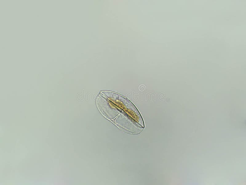 Amphora Spp.. Algen Onder Microscopisch Beeld Stock Foto - Image of ...