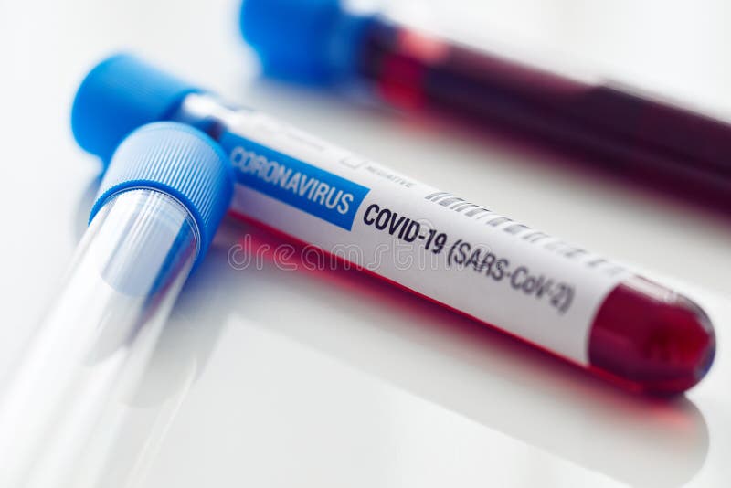 Ampoules with Blood Samples To Coronavirus, Covid-19 Test Stock Photo ...