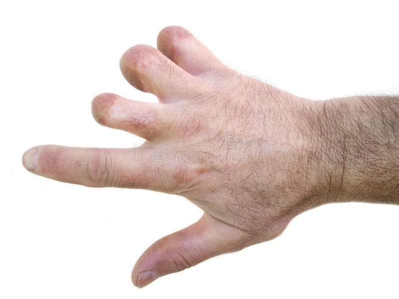 Amputated fingers stock image. Image of blood, scary - 18083479