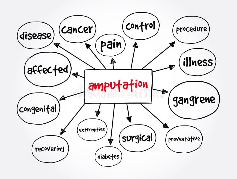 Amputation Mind Map, Medical Concept for Presentations and Reports ...