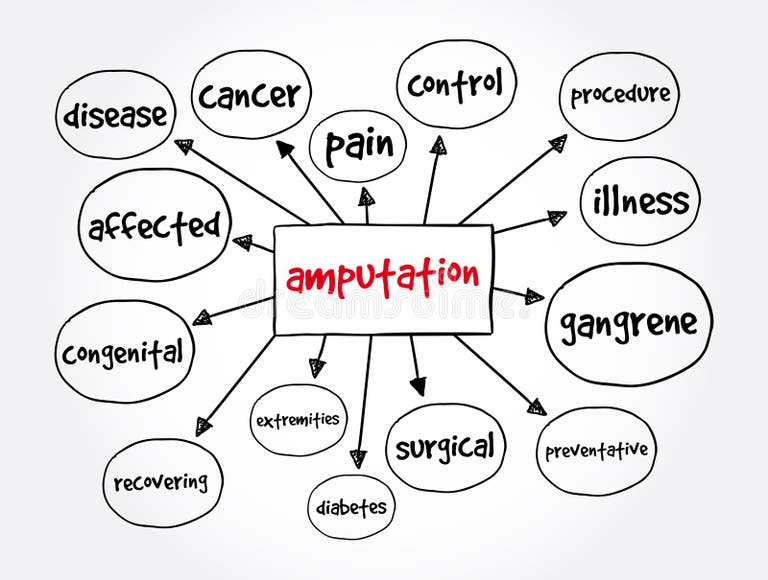 Amputation Mind Map, Medical Concept for Presentations and Reports ...