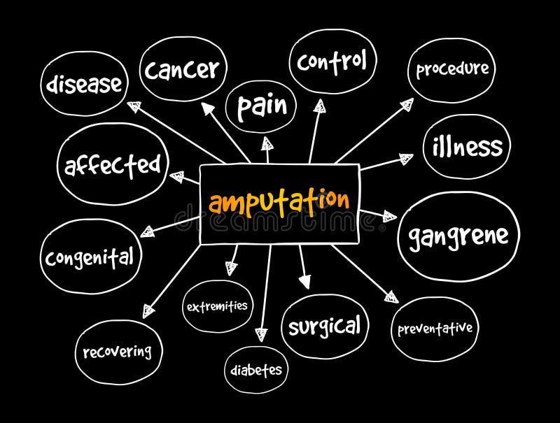 Amputation Mind Map, Medical Concept for Presentations and Reports ...
