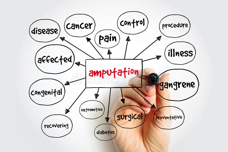 Amputation Mind Map Stock Illustrations – 6 Amputation Mind Map Stock ...