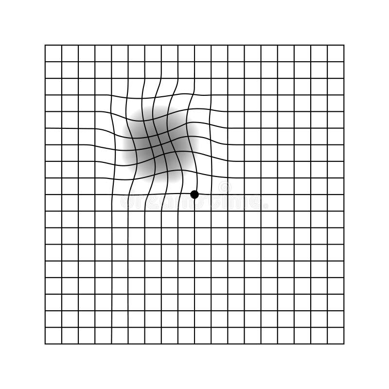 Amsler Eye Scotoma Test Grid. Vector Printable Chart Retina Examination ...