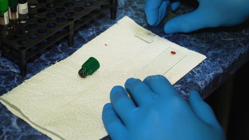 Analysis of Blood Samples in the Laboratory Stock Image - Image of ...
