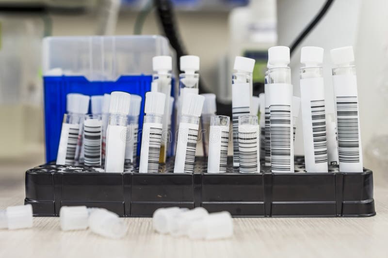 Analysis of Blood Tubes in Lab Stock Image - Image of control, medical ...