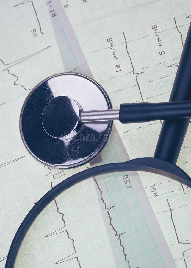 Analysis of Electrocardiogram. Stock Image - Image of electrocardiogram ...