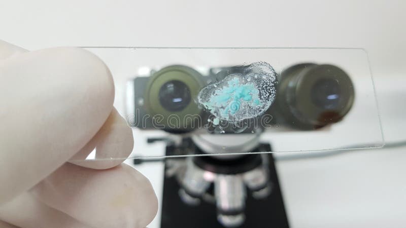 Analysis of Microbiological Sample Stock Photo - Image of discovery ...