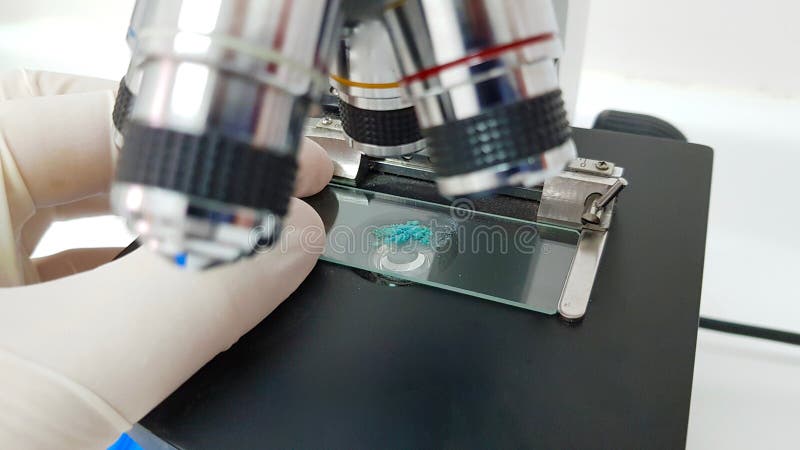 Analysis of Microbiological Sample Stock Photo - Image of test ...