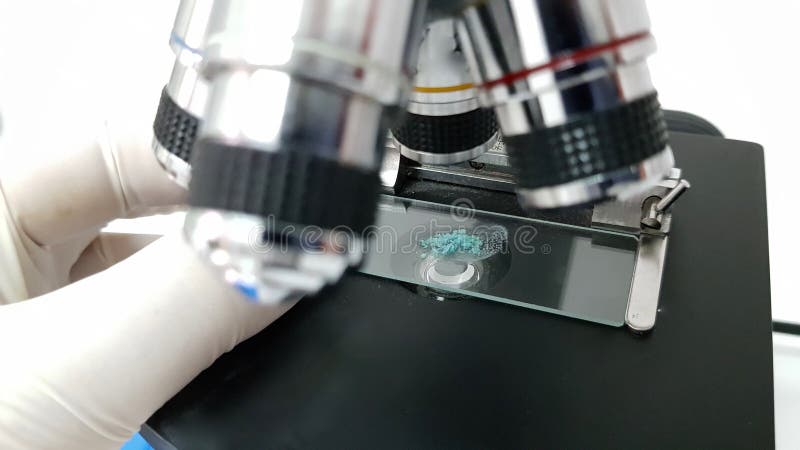 Analysis of Microbiological Sample Stock Image - Image of sample ...