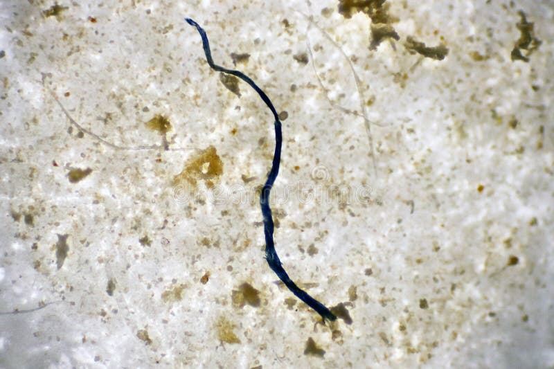 Analysis Morphology of Microplastic Waste Contaminated in Soil and ...