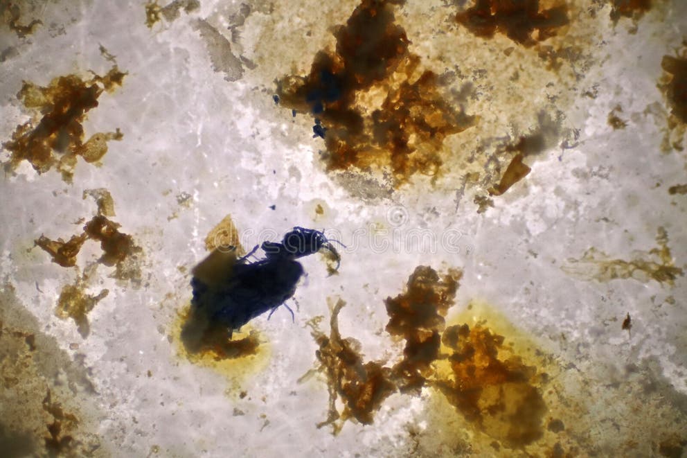 Analysis Morphology of Microplastic Waste Contaminated in Soil and ...