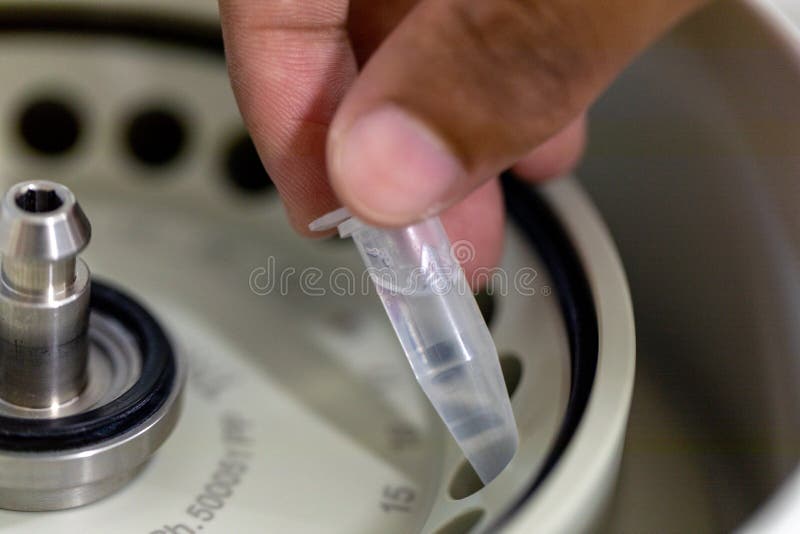 Analysis Protein for Study in Laboratory. Stock Image - Image of ...