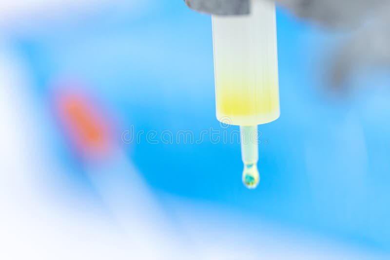 Analysis Protein for Study in Laboratory. Stock Photo - Image of ...