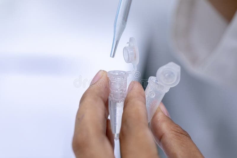 Analysis Protein for Study in Laboratory. Stock Image - Image of flask ...