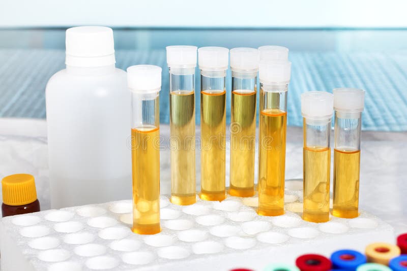 Urine test strips stock photo. Image of bottle, medical - 32337366