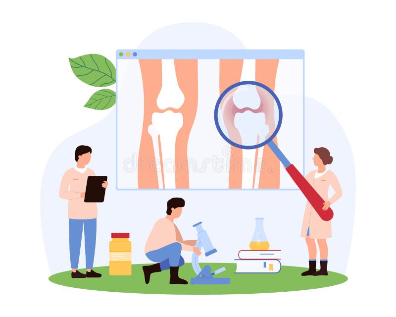 Analyzing Knee Joint Arthritis with Medical Tools Concept Stock ...