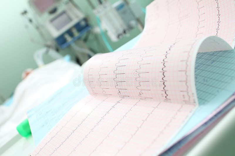 Analyzing Patient S ECG in ICU Stock Image - Image of line, brain: 58076789