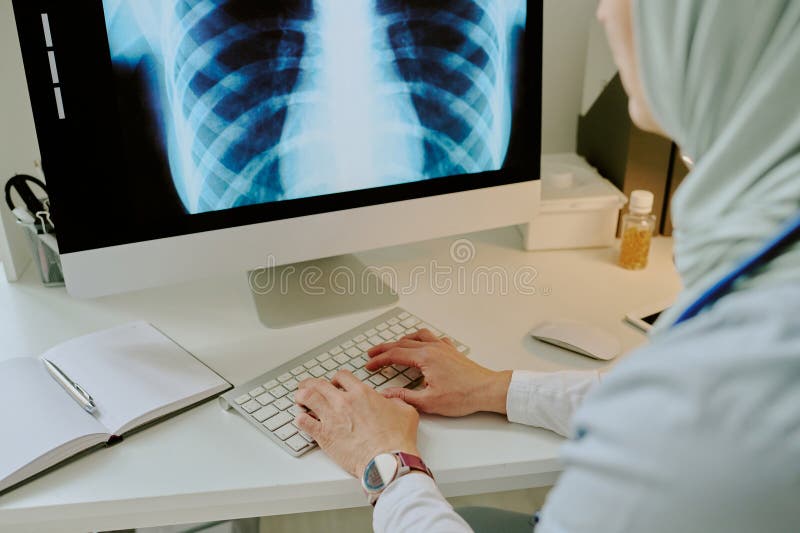 Analyzing X-Ray Results on Computer in Medical Office Stock Image ...