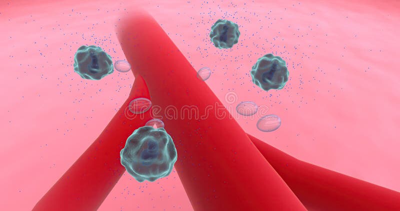 Anaphylaxis, Histamine Release and Vascular Edema Stock Illustration ...