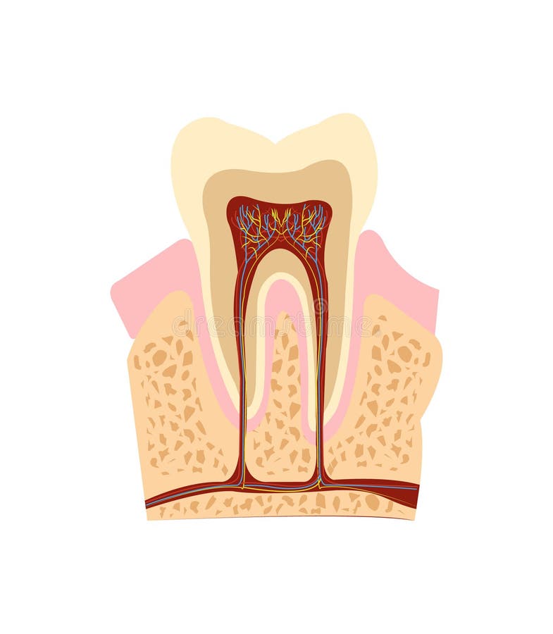 Anatomi Av En Tand Och En Tand- Implantat Vektor Illustrationer ...