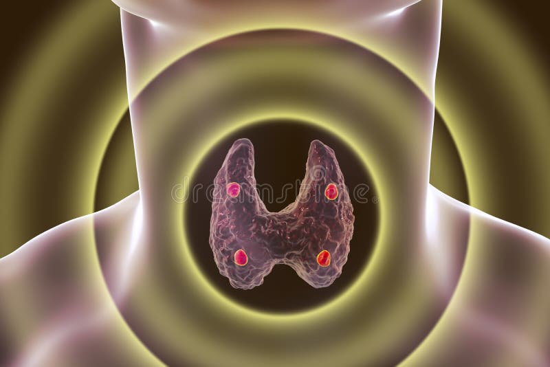 Anatomia Das Glândulas De Paratireoide Ilustração Stock - Ilustração de ...