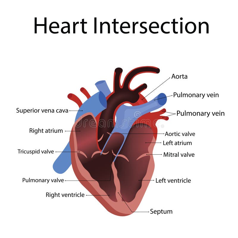Heart Anatomy and Types of Heart Disease Vector Illustration Ilustração ...