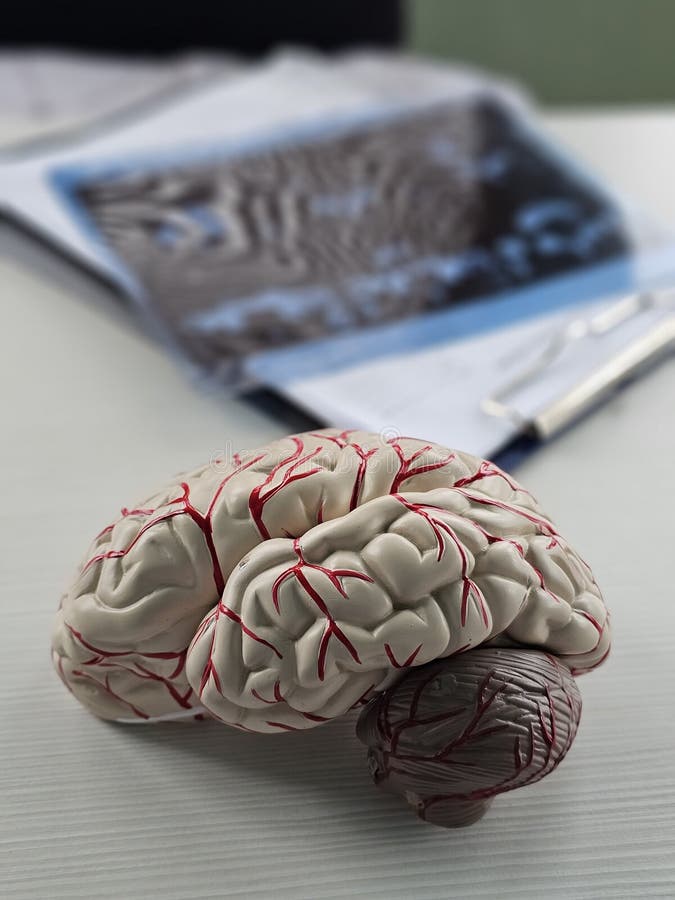 Anatomical Model of the Human Brain and MRI Concept Stock Image - Image ...