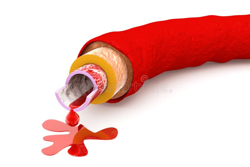 Anatomie Van Een Slagader Met Bloedcellen Stock Illustratie ...