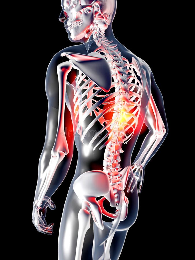 Anatomy - Back Pain stock illustration. Illustration of lumbar - 72742635