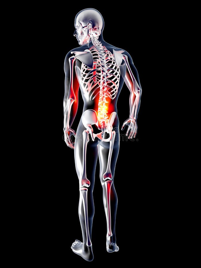 Anatomy - Back Pain stock illustration. Illustration of anatomy - 72743118