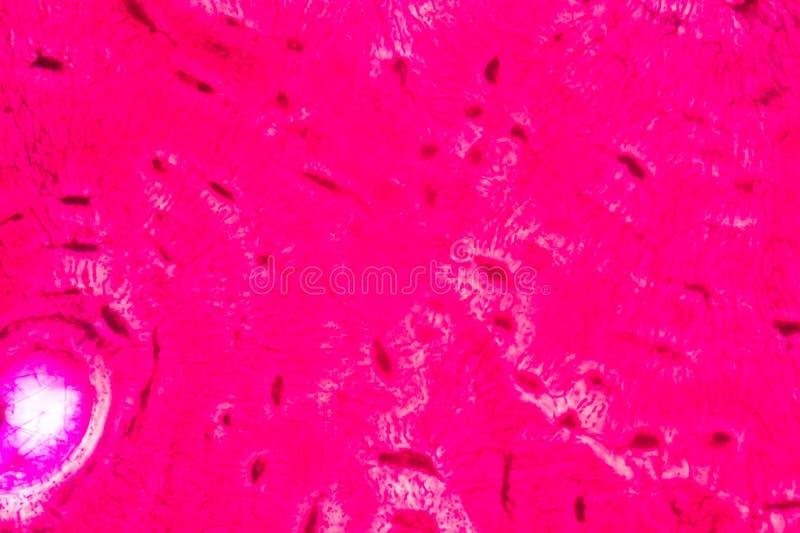 Histological Bone, Elastic Cartilage Human and Joint of Human Foetus ...
