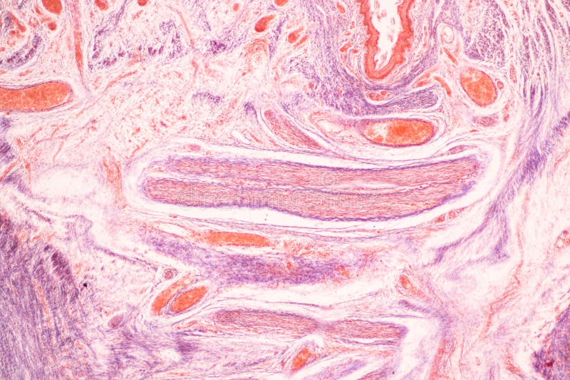 Histological Bone, Elastic Cartilage Human and Joint of Human Foetus ...