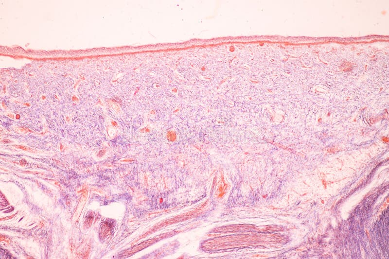 Histological Bone, Elastic Cartilage Human and Joint of Human Foetus ...