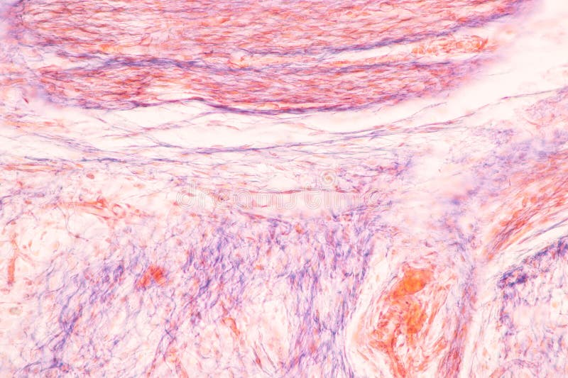 Histological Bone, Elastic Cartilage Human and Joint of Human Foetus ...