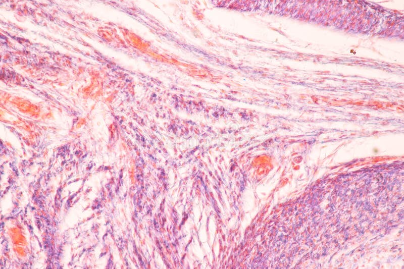 Histological Bone, Elastic Cartilage Human and Joint of Human Foetus ...