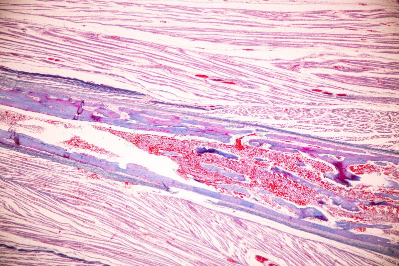 Histological Bone, Elastic Cartilage Human and Joint of Human Foetus ...