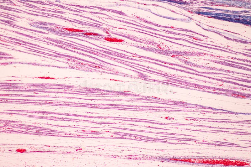 Histological Bone, Elastic Cartilage Human and Joint of Human Foetus ...
