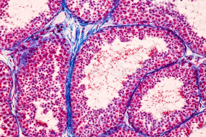 Histological Epididymis and Testis Human Cells Under Microscope. Stock ...